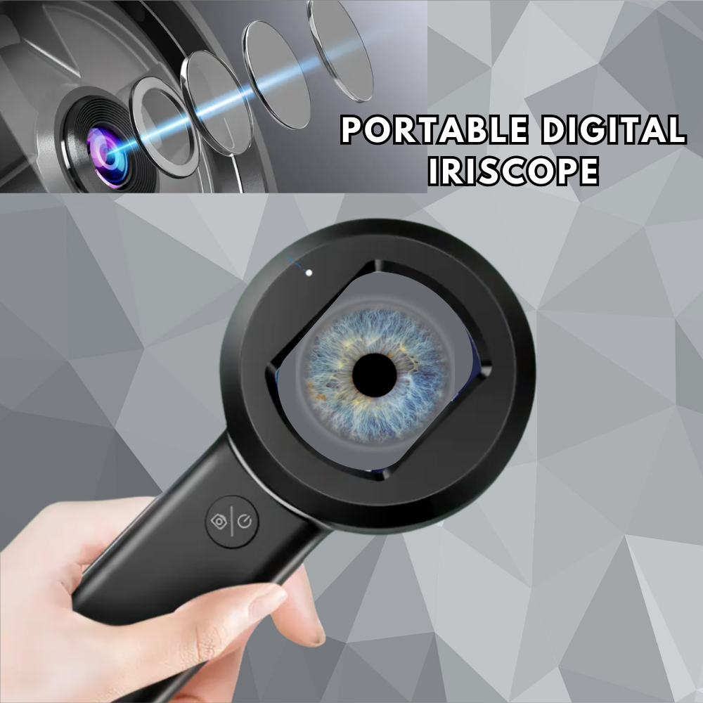pebble2go – Iridology cameras